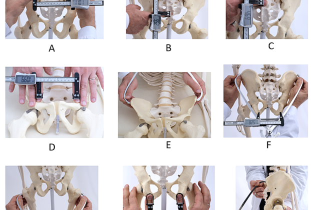 Physiologic Retraction Ring: An Essential Milestone in Labor ...