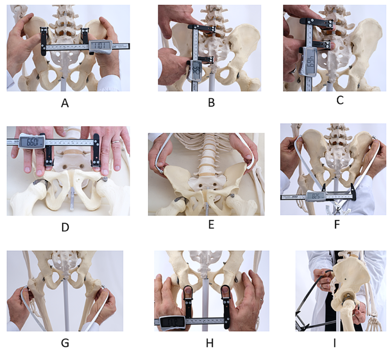 Bispinous Diameter: Understanding the Importance of Spinal Measurements ...