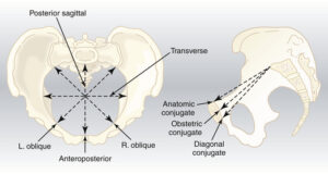 Posterior Sagittal Diameter: Understanding its Importance in ...
