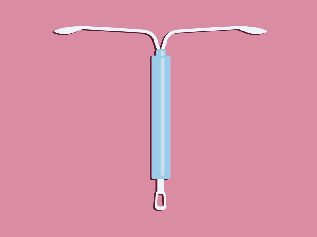 Discover the Surprising Truths: Pregnancy with IUD in Situ Explained ...