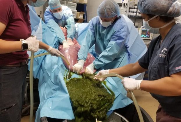 Fractional Curettage: A Minimally Invasive Procedure for Uterine Health ...