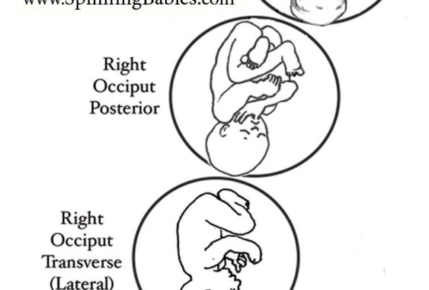 The Left Mentoanterior Position: Understanding Fetal Presentation ...